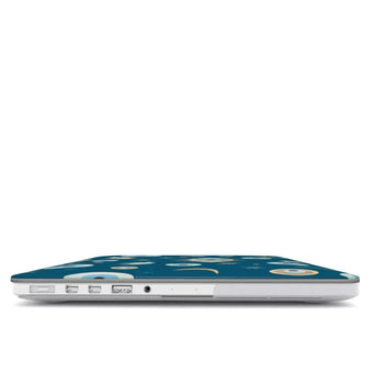 Greek Evil Eye MacBook Case – The Global Wanderer